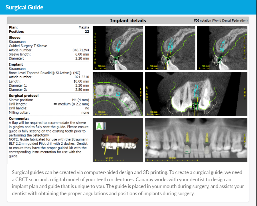 Services Offered at Canaray – Canaray